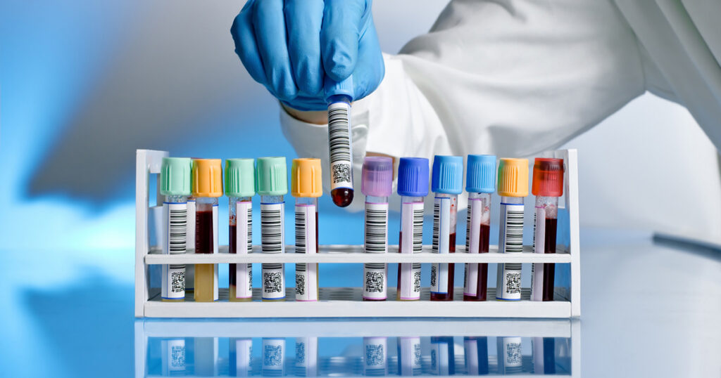 Temperature Monitoring for Blood Banks: Protecting Blood Products for ...